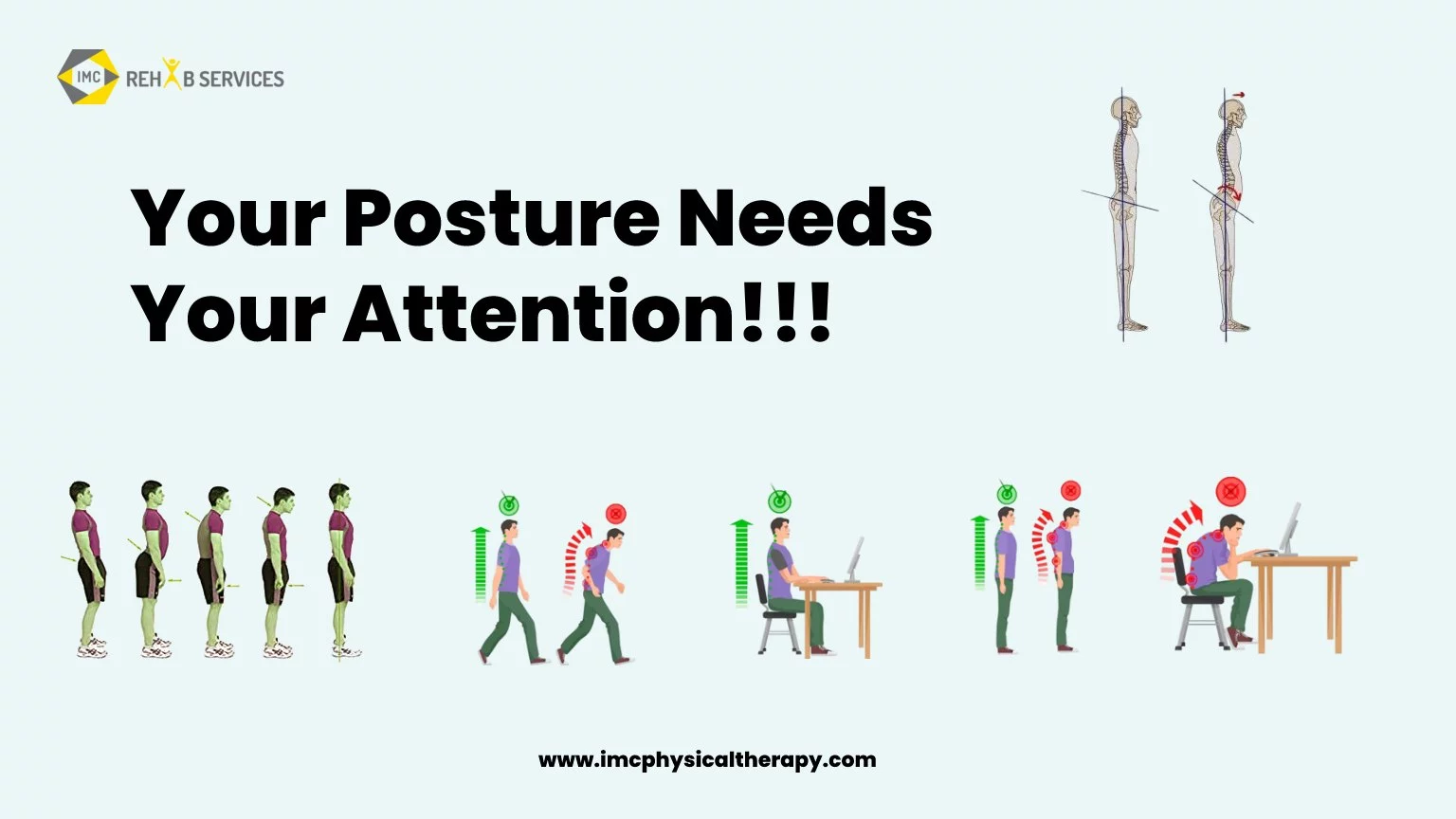 Your Posture Needs Your Attention! - IMC Physical Therapy Services